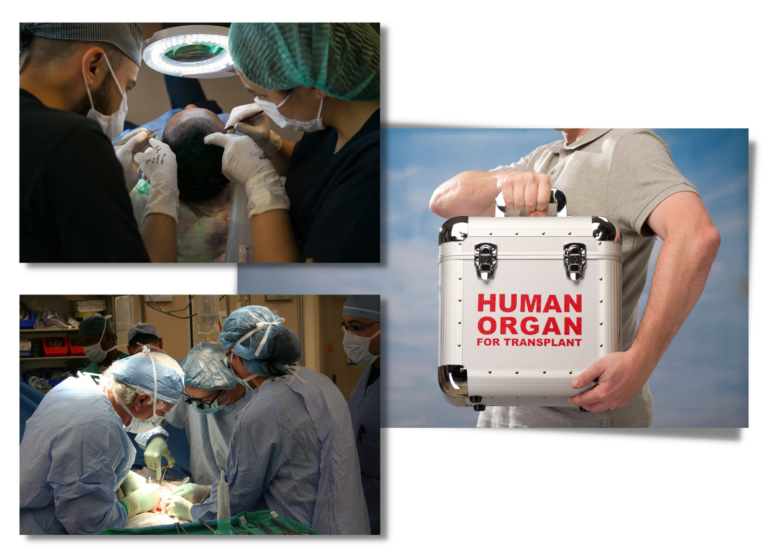 ORGAN TRANSPLANT SURGERY IN INDIA – Human Approach